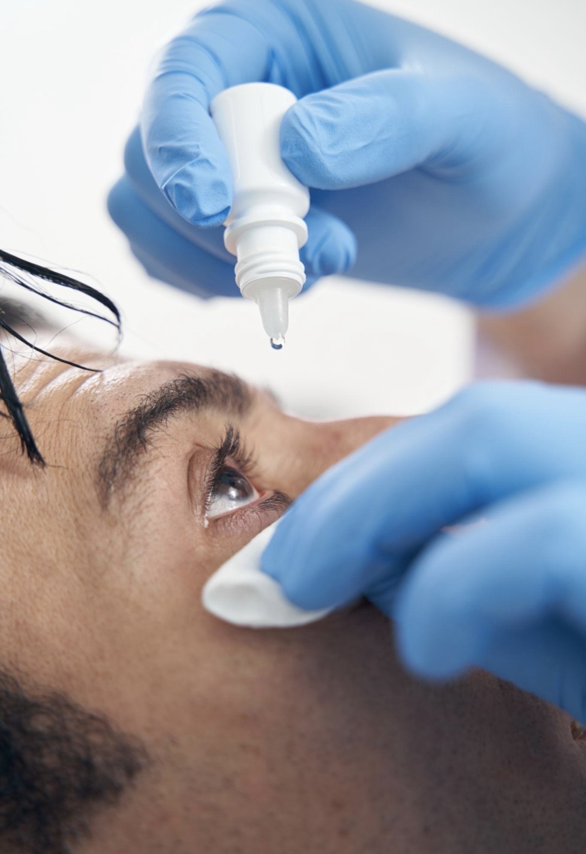 Understanding Corneal Ulcer: Causes, Symptoms, and Treatment ...
